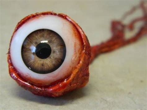 Eyeball Hanging Out Of Socket