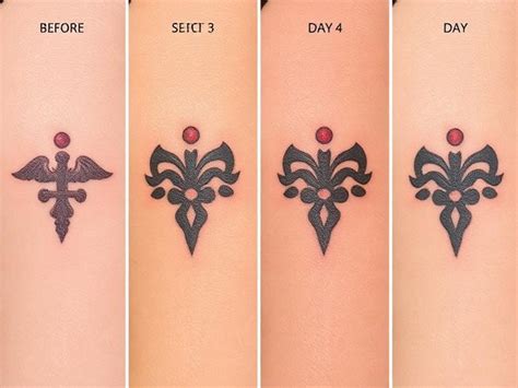 Tattoo Healing Stages Day By Day A Complete Guide