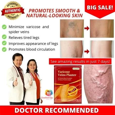 Flash Sale 💯 Original Varicose Veins Plaster Vasculitis Phlebitis Spider Cream Varicosity