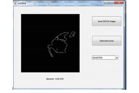Gui For The Detection Of Tumor Portion And Displaying The Diameter Of