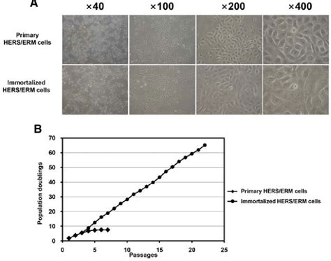 Characterization Of Primary Hers Erm Cells And Immortalized Hers Erm Download Scientific
