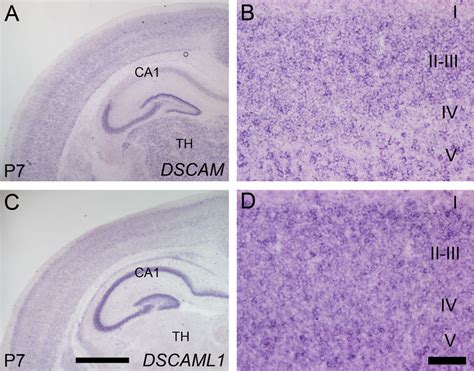 The Expression Of Dscam And Dscaml1 In Mouse Cerebrum At P7 A In Download Scientific Diagram