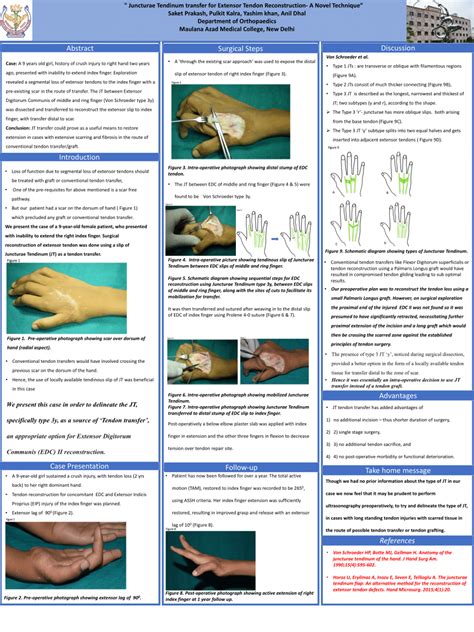 Pdf Juncturae Tendinum Transfer For Extensor Tendon Reconstruction A Novel Technique