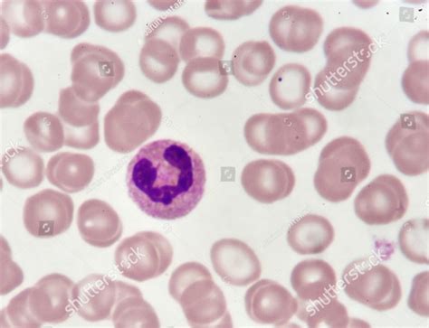 Leukocyte Morphology Flashcards Quizlet