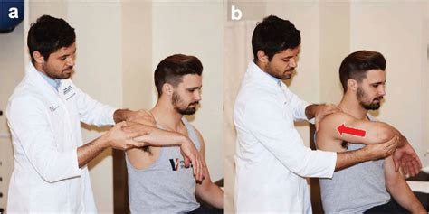 Jerk Test A The Patients Affected Arm Is Abducted 90° And