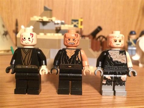First Second And Third Degree Burns R Starwars