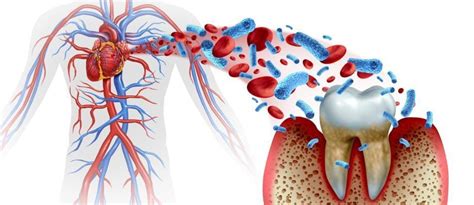 Connection Between Cardiovascular Health And Oral Health