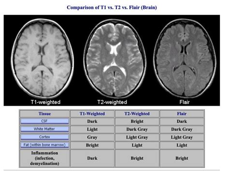 Interpreting Mri Medical Radiography Radiology Imaging Medical School Stuff