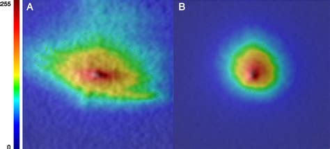 Interocular Differences In Visual Quality Due To Ocular Aberrations And