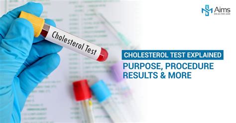Hdl Blood Test Results Explained Infoupdate Org