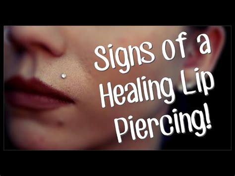 Normal Lip Piercing Healing Process