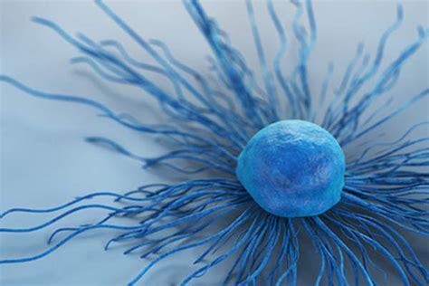 Hpv和头颈癌：你需要知道什么 Biwei必威betway必威官网注册必威体育 西汉姆联