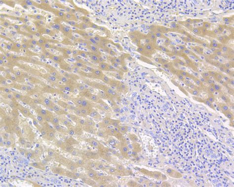 Complement Factor B Rabbit Polyclonal Antibody Ha500036 Huabio Complement Factor B Rabbit Polyclonal Antibody Ha500036 Huabio