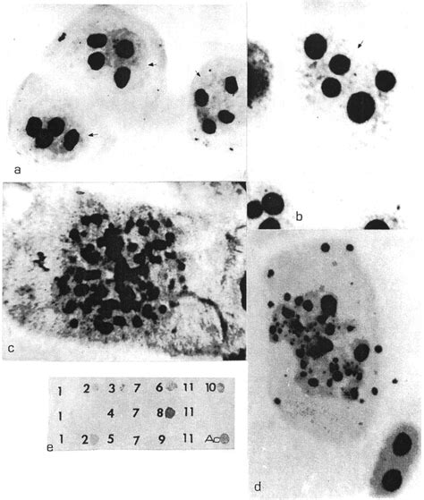 A E A H Nucleoli Of Interphase Nuclei After Silver Staining A With 4