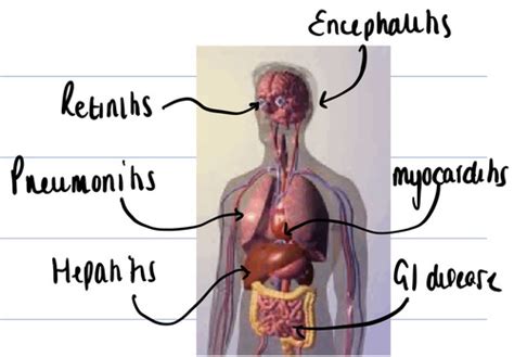 Herpes Virus Flashcards Quizlet
