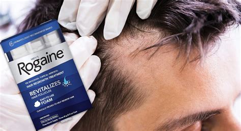 The Truth About Rogaine Topical Minoxidil What You Need To Know