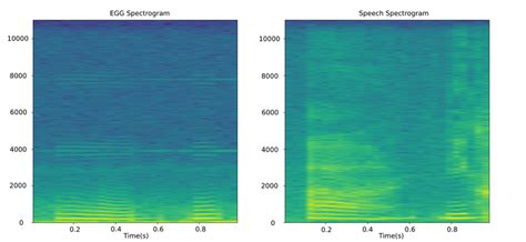 A Comparison Between The Spectrograms Of Egg Signals And Speech Signals Download Scientific