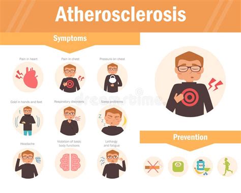 Atherosclerosis Symptoms Vector Stock Vector Illustration Of Info