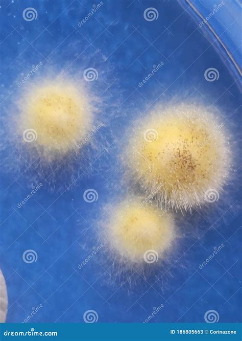 Aspergillus Niger And Aspergillus Oryzae Mold Under Microscope Stock Image