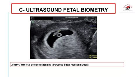 How To Calculate Gestational Age Pdf Pregnancy Reproductive Health