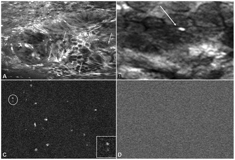 In Vivo Visualization Of Intramucosal Bacteria Within The Colonic