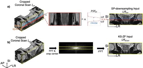 Figure From High Resolution D Mri With Deep Generative Networks Via Novel Slice Profile