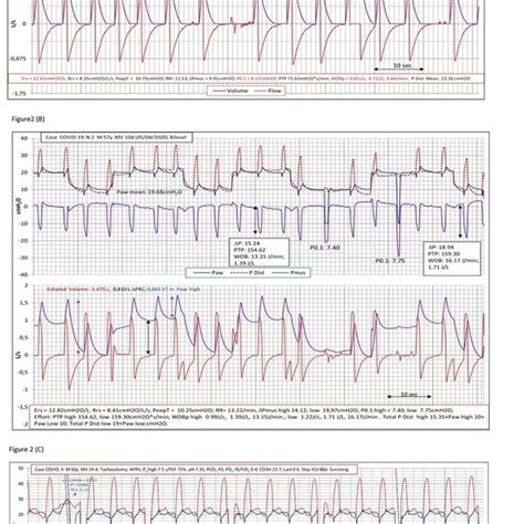 Physiologic Effects Of Hfnc Download Scientific Diagram