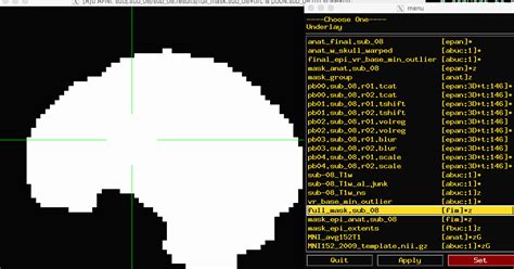 Chapter 7 Checking Preprocessing — Andys Brain Book 10 Documentation