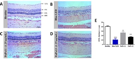 Histological Retinal Sections Analysis A Normal Retinal Layers In
