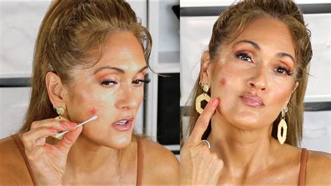 How To Hide Scabs On Face Without Makeup Saubhaya Makeup