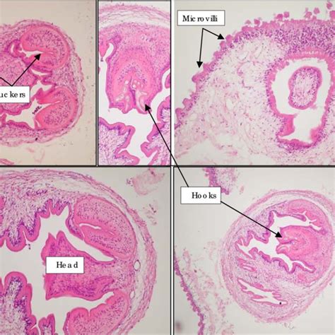 Pdf Taenia Multiceps A Rare Human Cestode Infection In Israel
