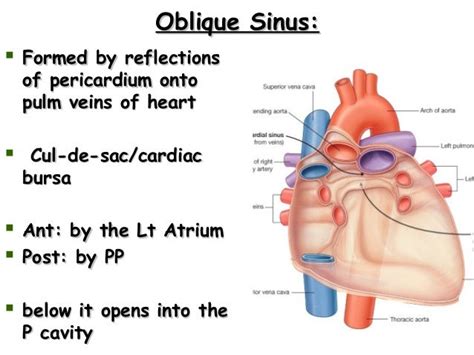 Oblique Pericardial Sinus