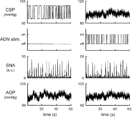 Typical Recordings Of The Open Loop Left And Closed Loop Right Download Scientific Diagram
