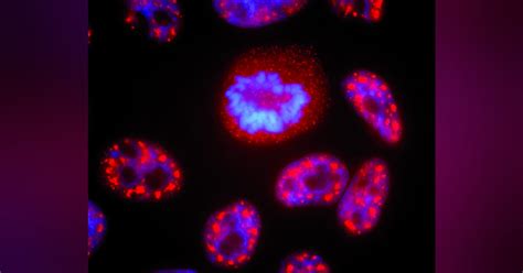 Solid State Light Sourcesfluorescence Microscopy Hybrid Approach Lets