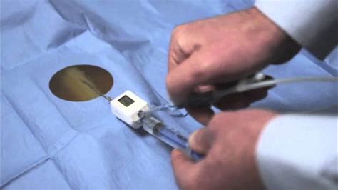 Compass™ Vascular Access Tutorial Youtube