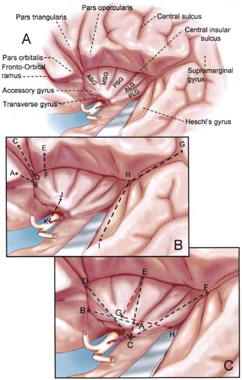 Insula And Sylvian Fissure The Neurosurgical Atlas