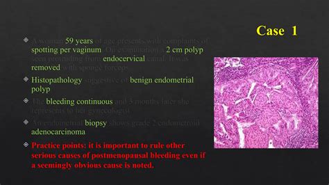 Postmenopausal Vaginal Bleeding Approachpptx