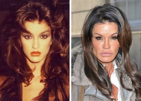 Celebrities Before And After Plastic Surgery Celebrities