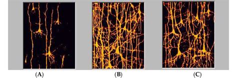 We See The Complexity Of Dendritic Structures Of Cortical Neurons