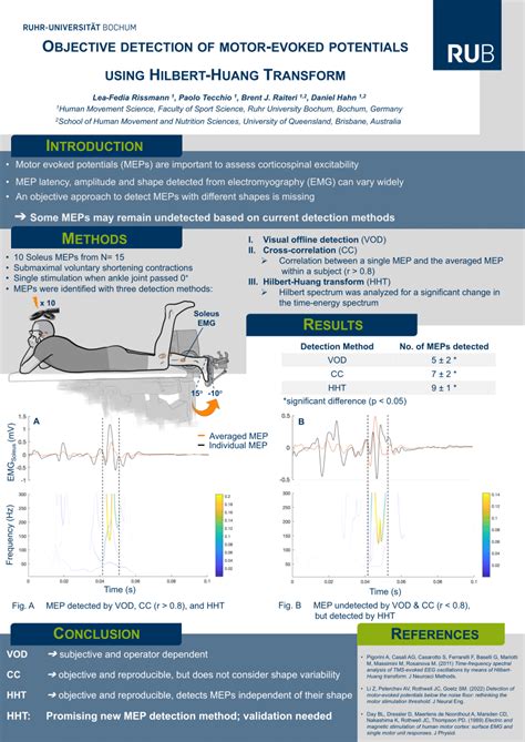 Pdf Objective Detection Of Motor Evoked Potentials Using Hilbert