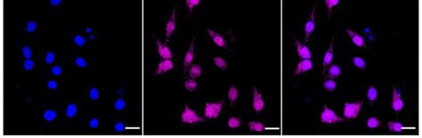Prepl Recombinant Monoclonal Antibody 24gb990 Ma5 57638