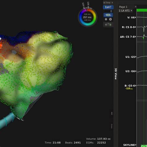 Electroanatomic Mapping Of The Left Atrium Performed With The Download Scientific Diagram