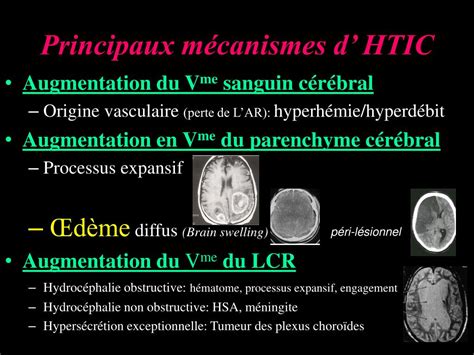 Ppt Physiopathologie De Lhypertension Intra Cranienne Htic Powerpoint Presentation Id3524478