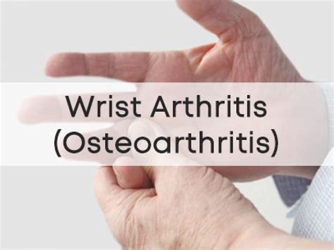 Osteoarthritis Wrist Osteoarthrosis Of The Hand Physio Check