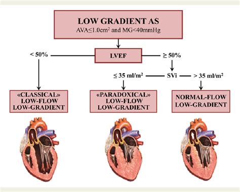 Low Flow Low Gradient Aortic Stenosis Diagnosis Torrie Salinas
