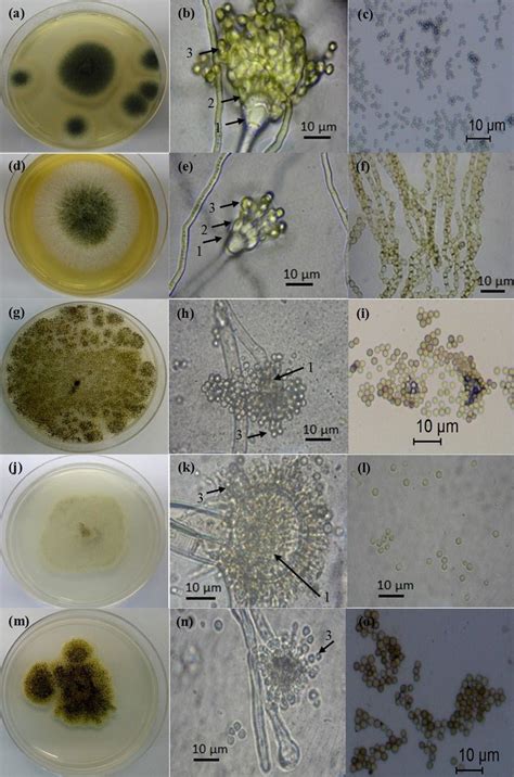 Aspergillus Microscopic Microscope World Blog Aspergillus Mold