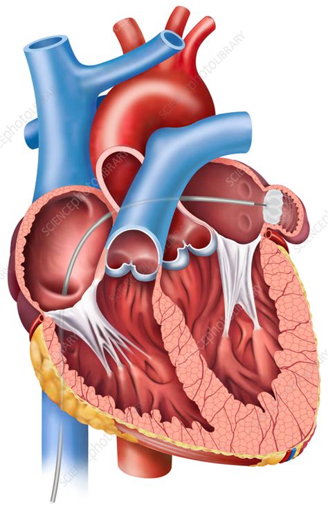Left Atrial Appendage Illustration Stock Image F0457700 Science