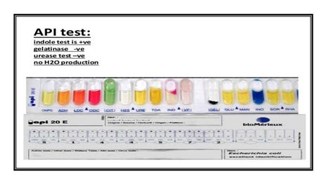Api 20 E System And Antibiotic Susceptibility Test Ppt Download
