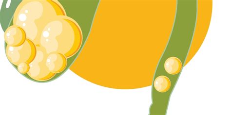 Coledocolitiasis Causas Síntomas Diagnóstico Tratamiento Y Prevención