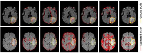 comparative results of different algorithms tested for the segmentation